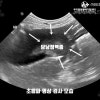 강아지 배가 딱딱해서 검사 받으러 갔어요 초음파 검사에서 담낭이 이상한 걸 발견했어요 강아지 담낭점액종 수술